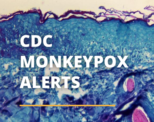 CDC Monkeypox Alerts